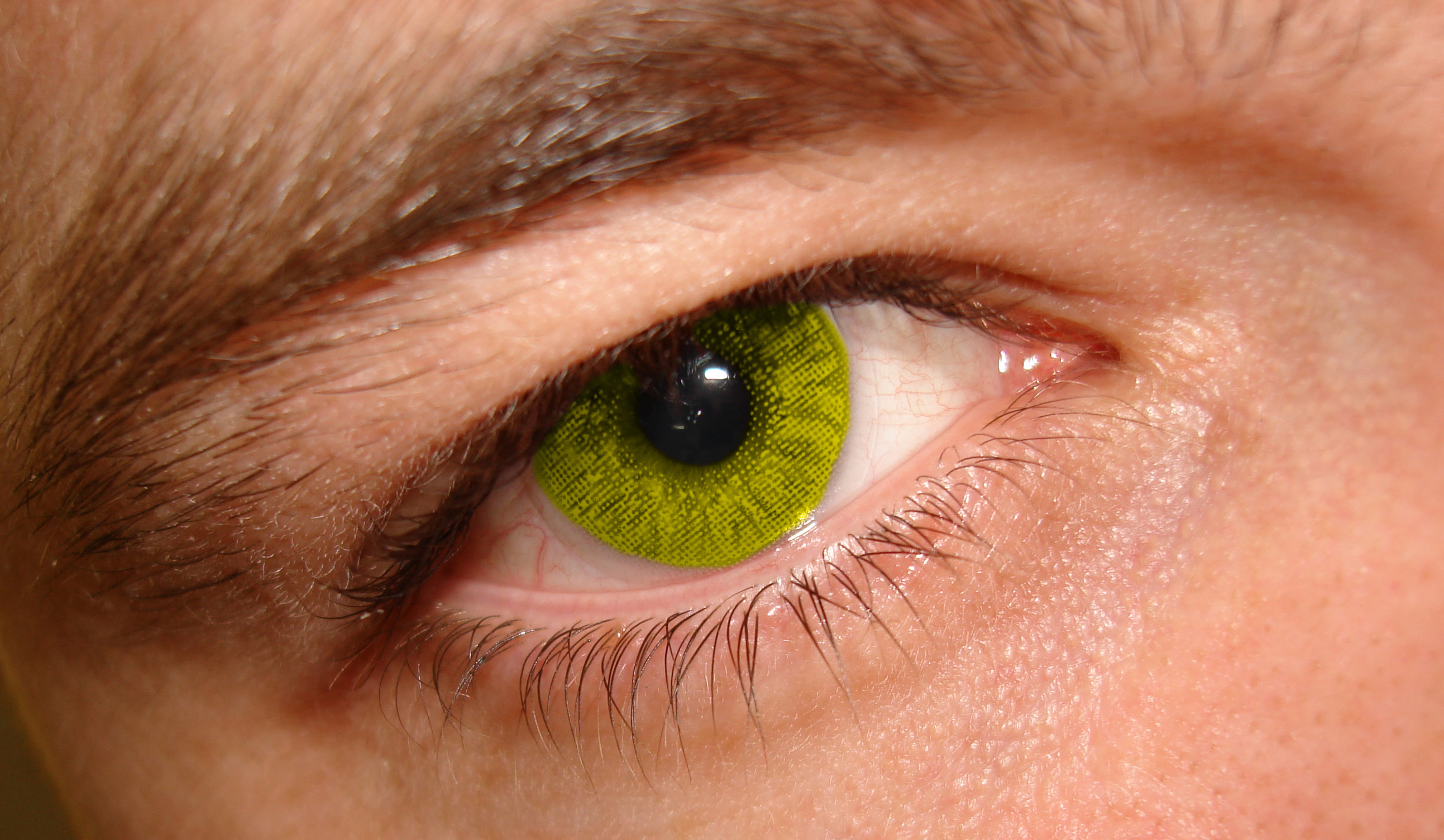 High-tech contact lens is developed to help glaucoma patients be aware ...